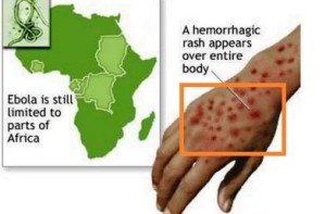 Maculopapular Rash - Pictures, Treatment, Symptoms, Causes