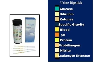 Urobilinogen in Urine Causes, Procedure, Values, Clinical